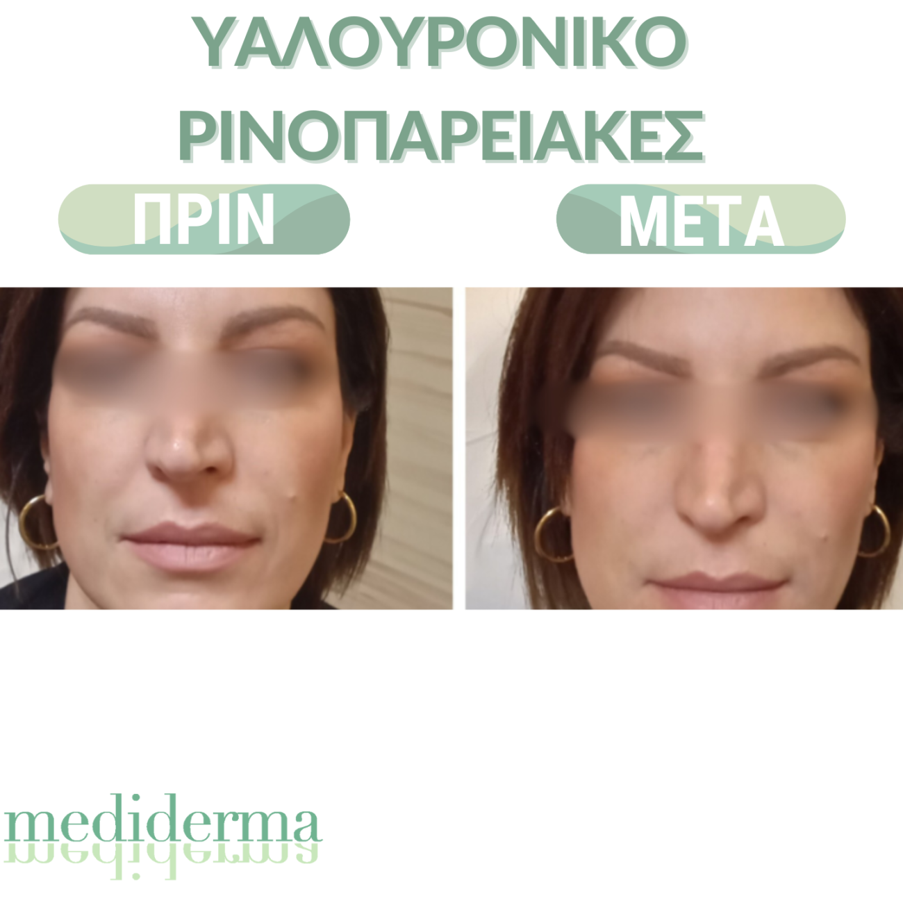 BeforeAfter - Medi Derma